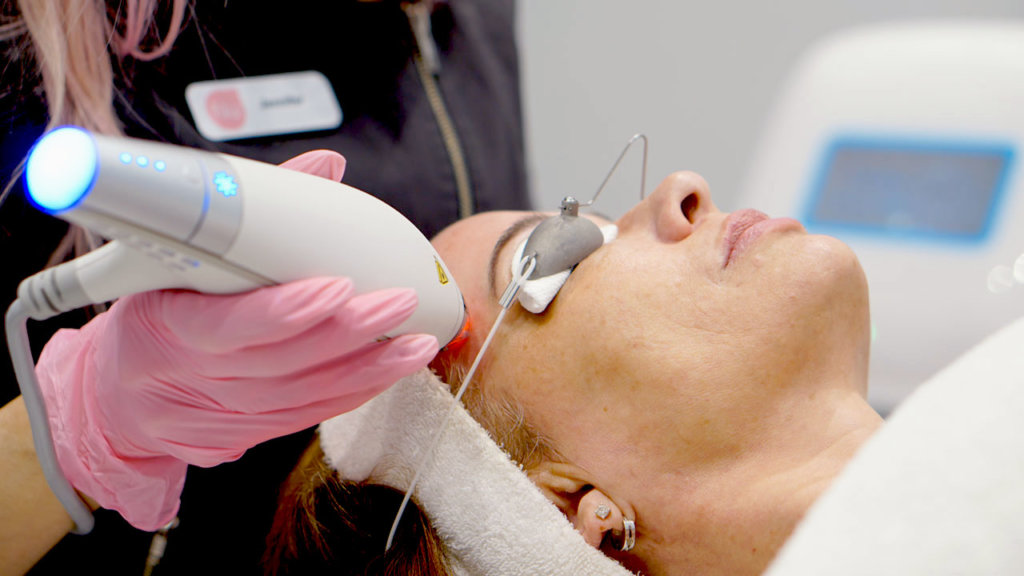 Dark Spots + Hyperpigmentation - NuAGE Laser