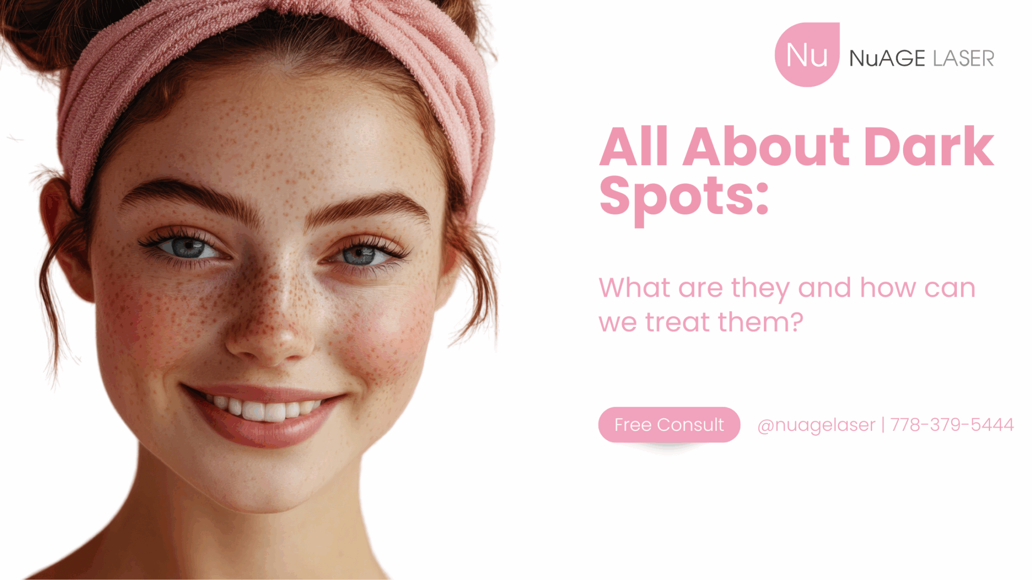 Different Types of Dark Spots and Treatments